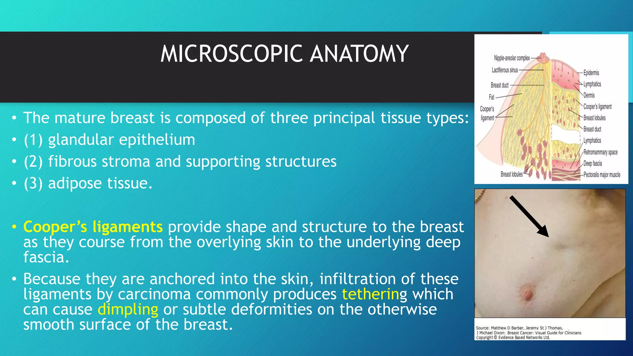 Benign breast lesions | PPTX