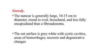 Benign breast lesions.pptx benign breast lesions | PPTX