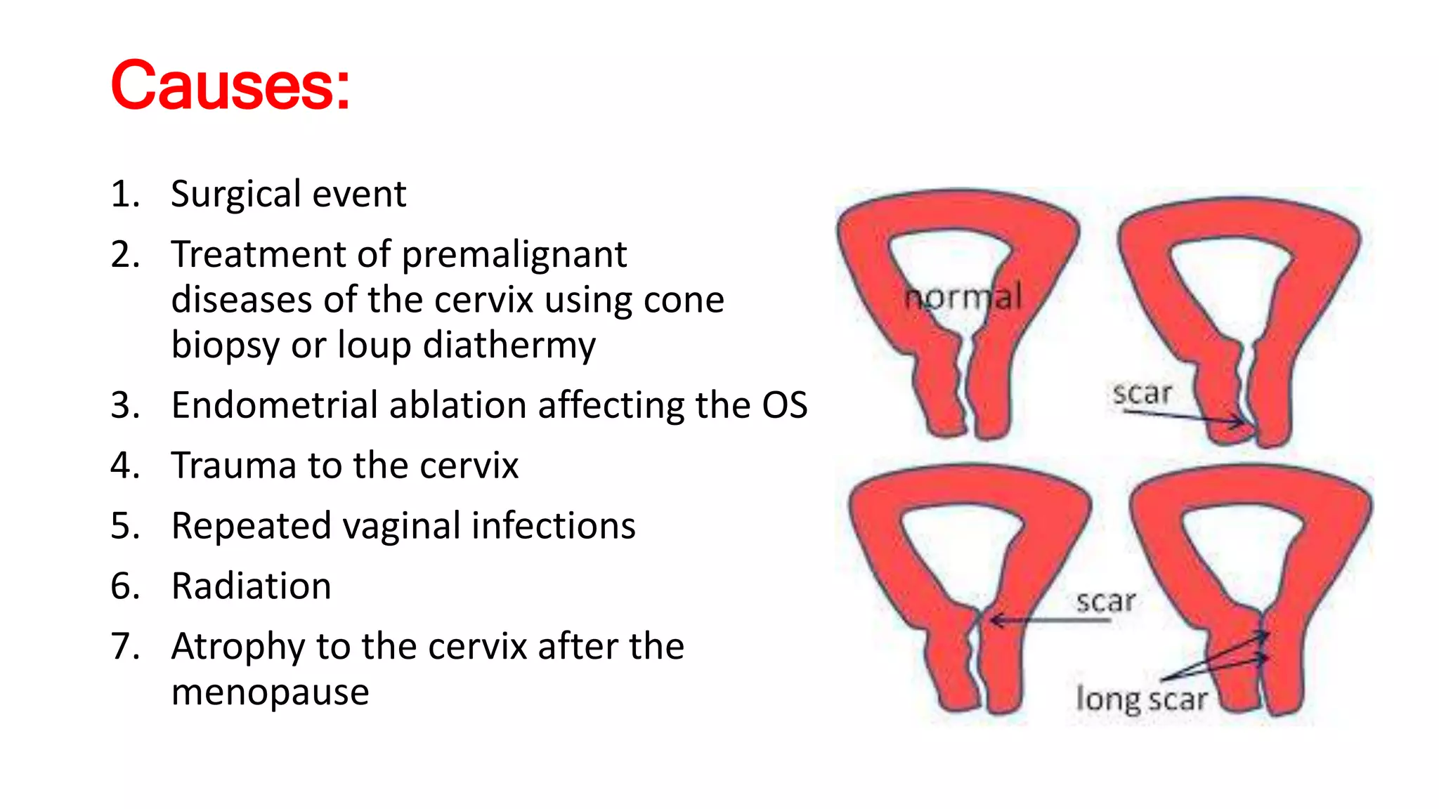 Benign Cervical Lesions | PPTX