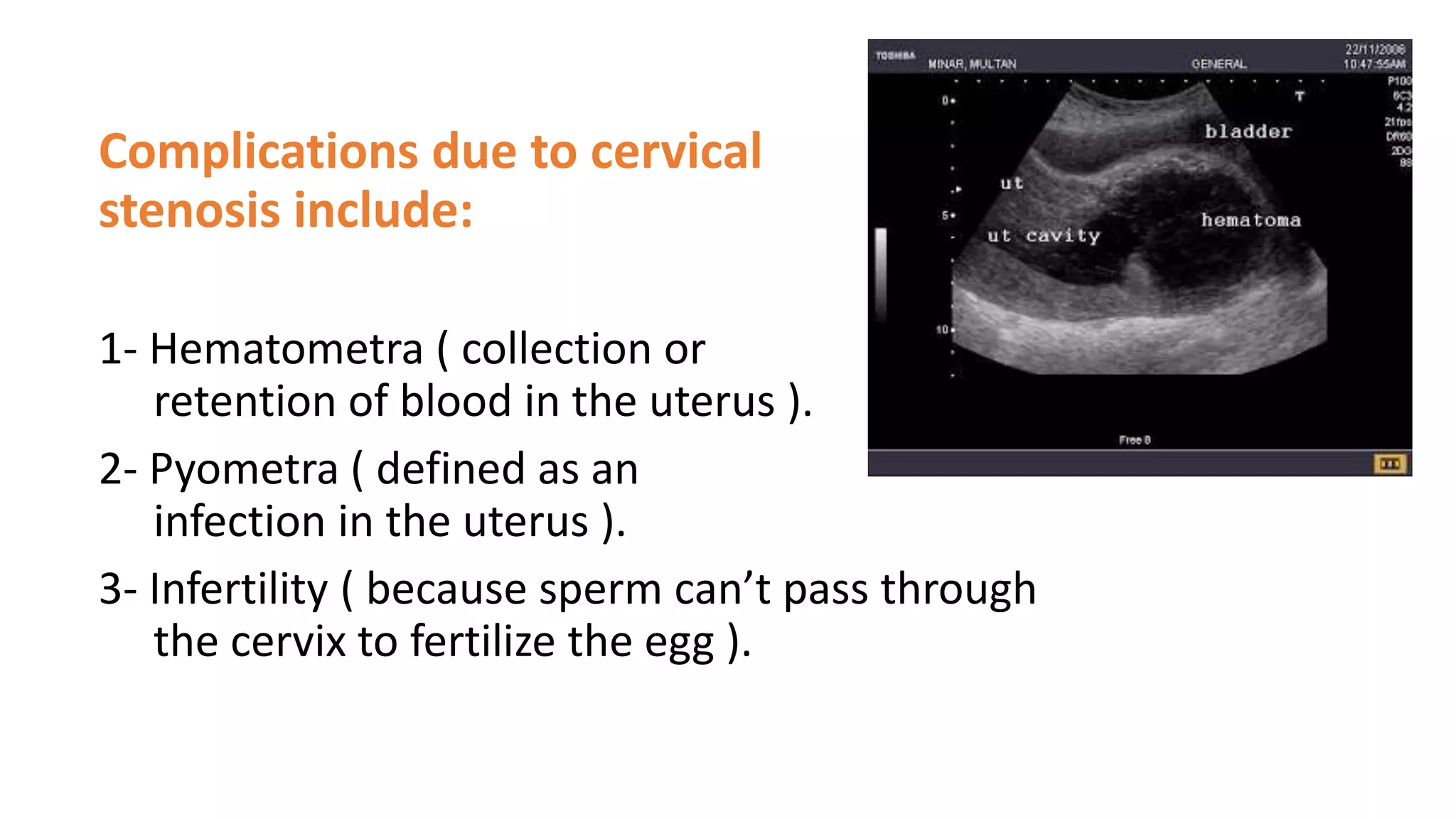 Benign Cervical Lesions | PPTX