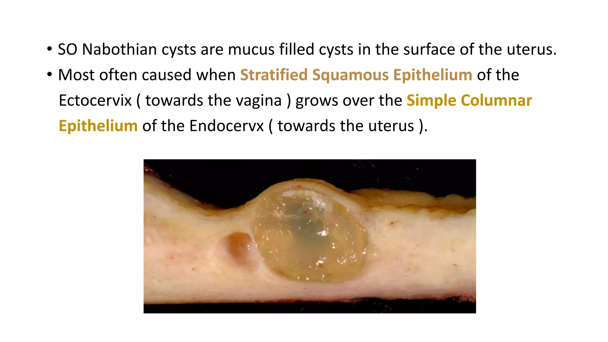 Benign Cervical Lesions | PPTX