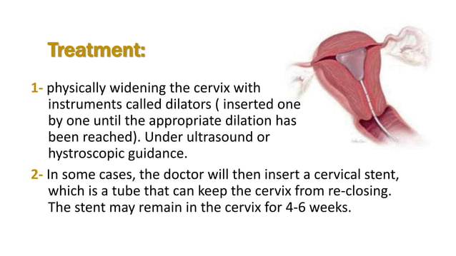 Benign Cervical Lesions | PPTX