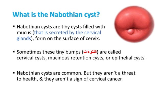 Benign Cervical Lesions | PPTX