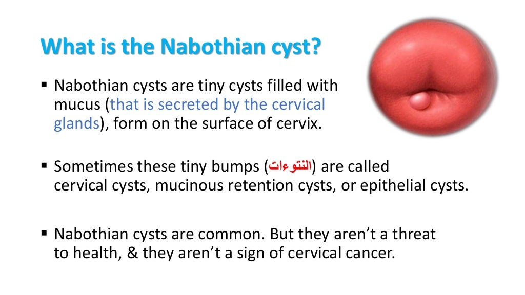 Benign Cervical Lesions