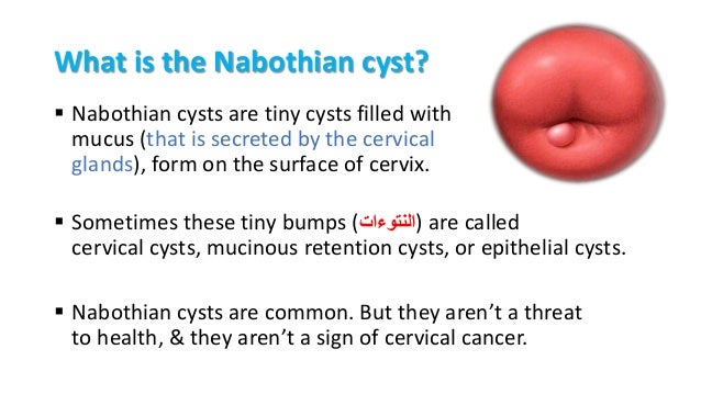 Benign Cervical Lesions