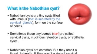 benigncervicallesions-180223153134 (1).pptx