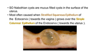 benigncervicallesions-180223153134 (1).pptx