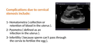 benign cervical lesions gynecology and obstetrics.pptx