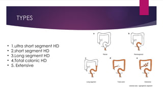 BENIGN CONDITIONS OF LARGE BOWEL.FINAL.pptx