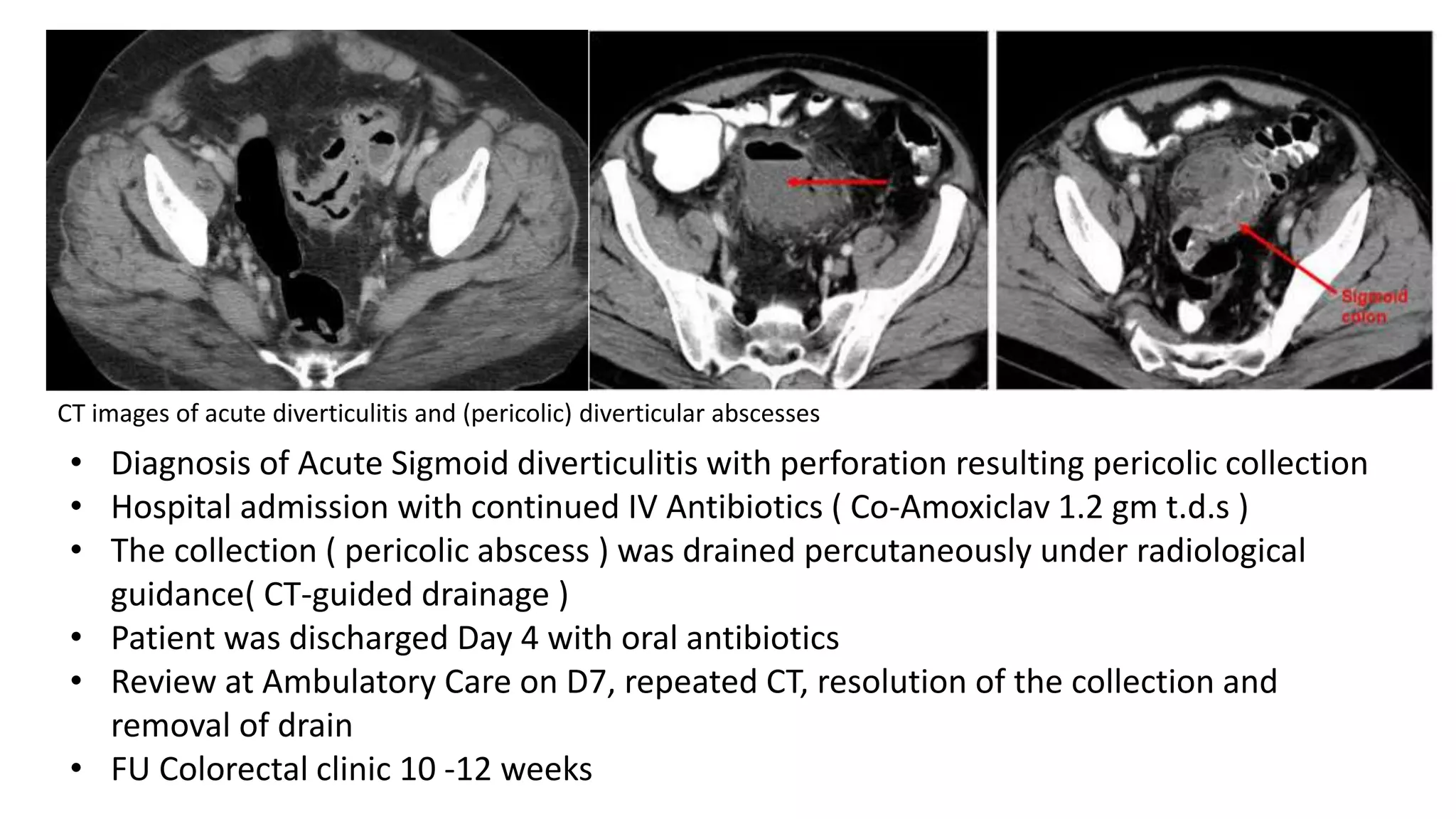 Benign CR Diseases.pptx
