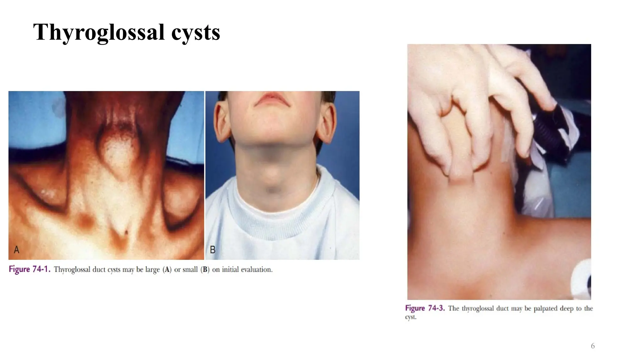 benign disease of neck pictures-2 part.pptx