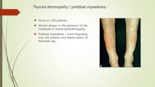 BENIGN DISEASE OF THYROID presentation p | PPTX