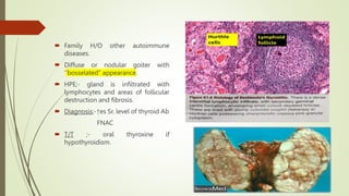 BENIGN DISEASE OF THYROID presentation p | PPTX