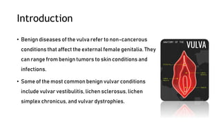 Benign Disease Of Vulva.pptx