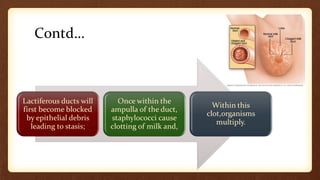 Benign diseases of breast | PPT | Cancer | Diseases and Conditions