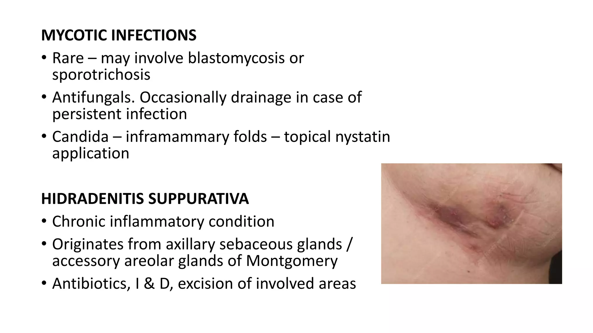 BENIGN DISEASES OF THE BREAST.pptx
