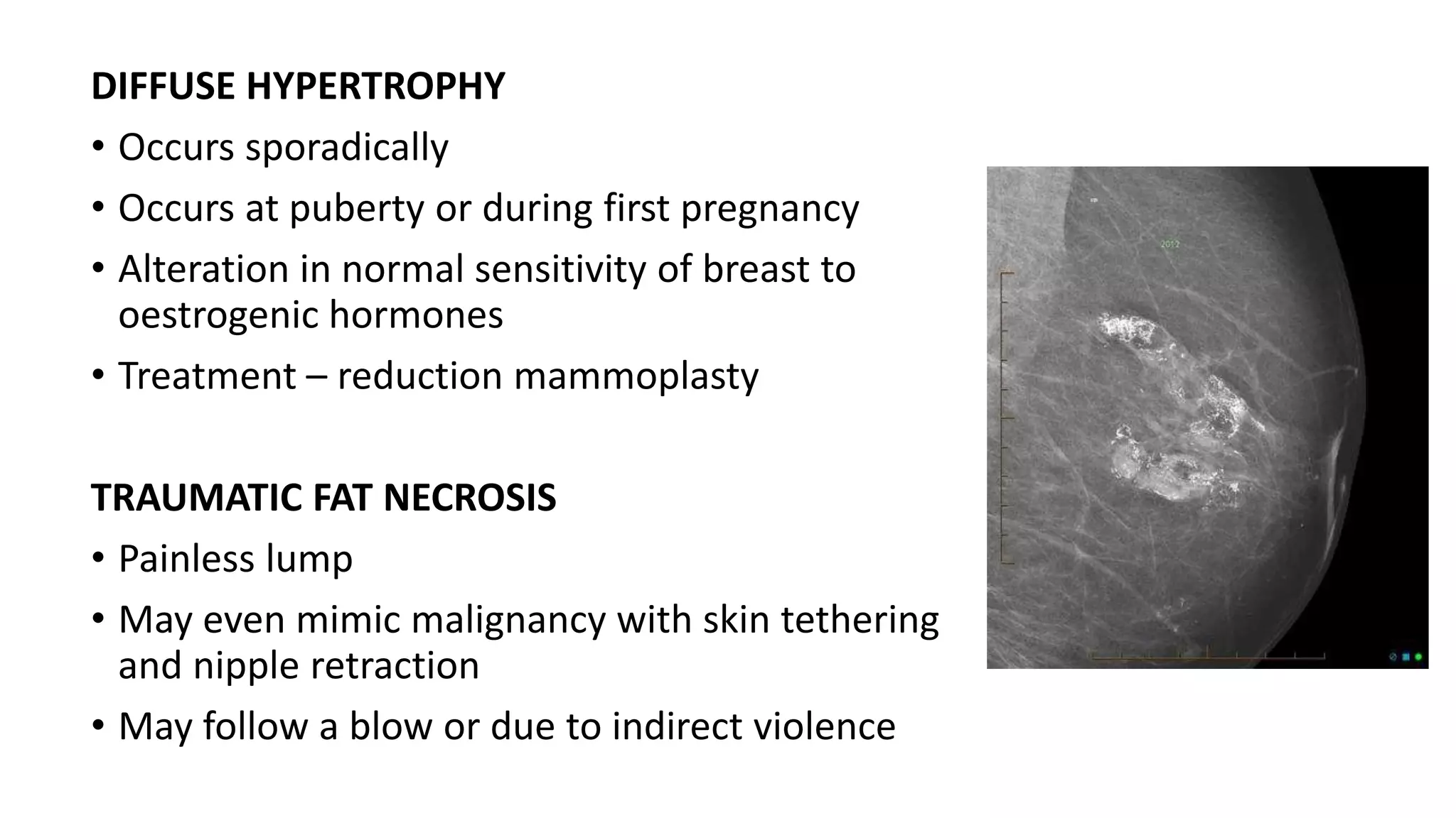 BENIGN DISEASES OF THE BREAST.pptx