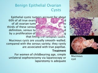 Benign diseases of the ovary | PPTX