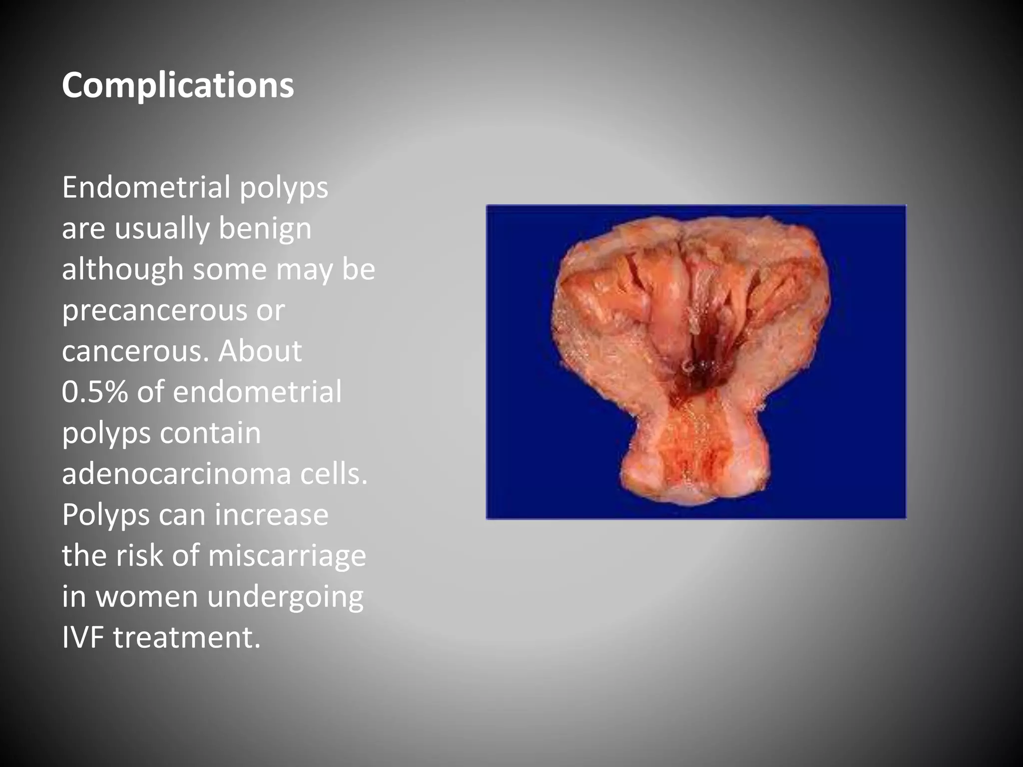 Benign diseases of the uterus and cervix | PPTX