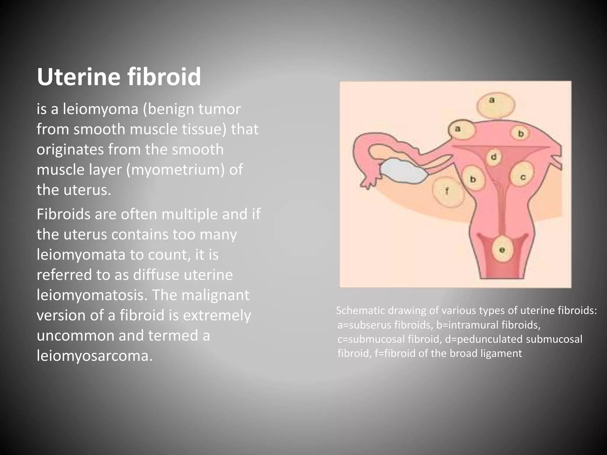 Benign diseases of the uterus and cervix | PPTX