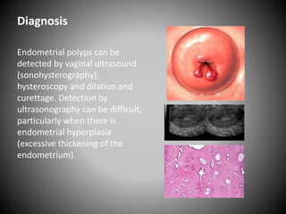 Benign diseases of the uterus and cervix | PPTX