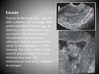 Benign diseases of the uterus and cervix | PPTX