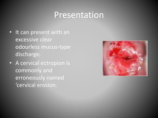 Benign diseases of the uterus and cervix | PPTX