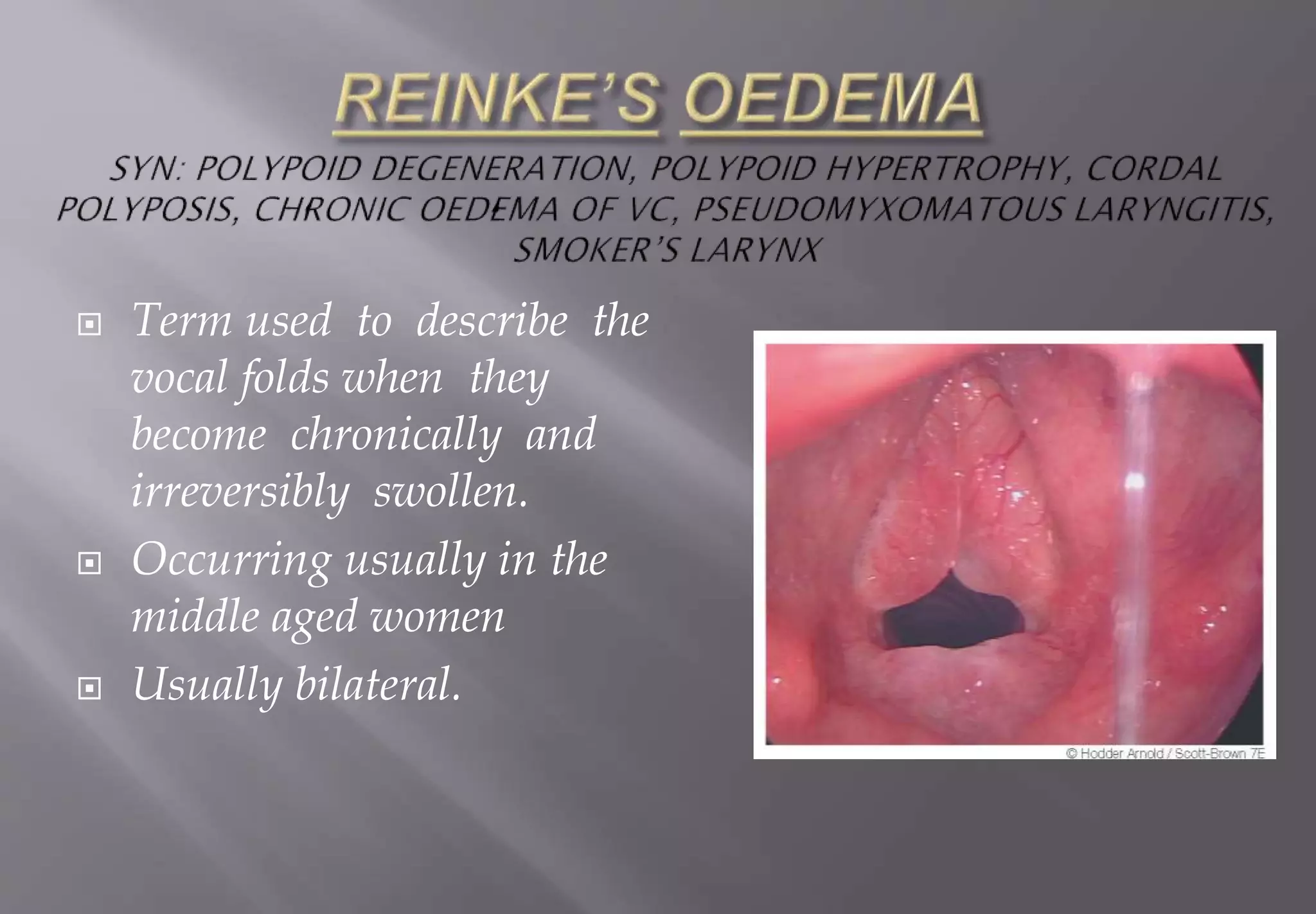 Benign disorders of larynx | PPTX