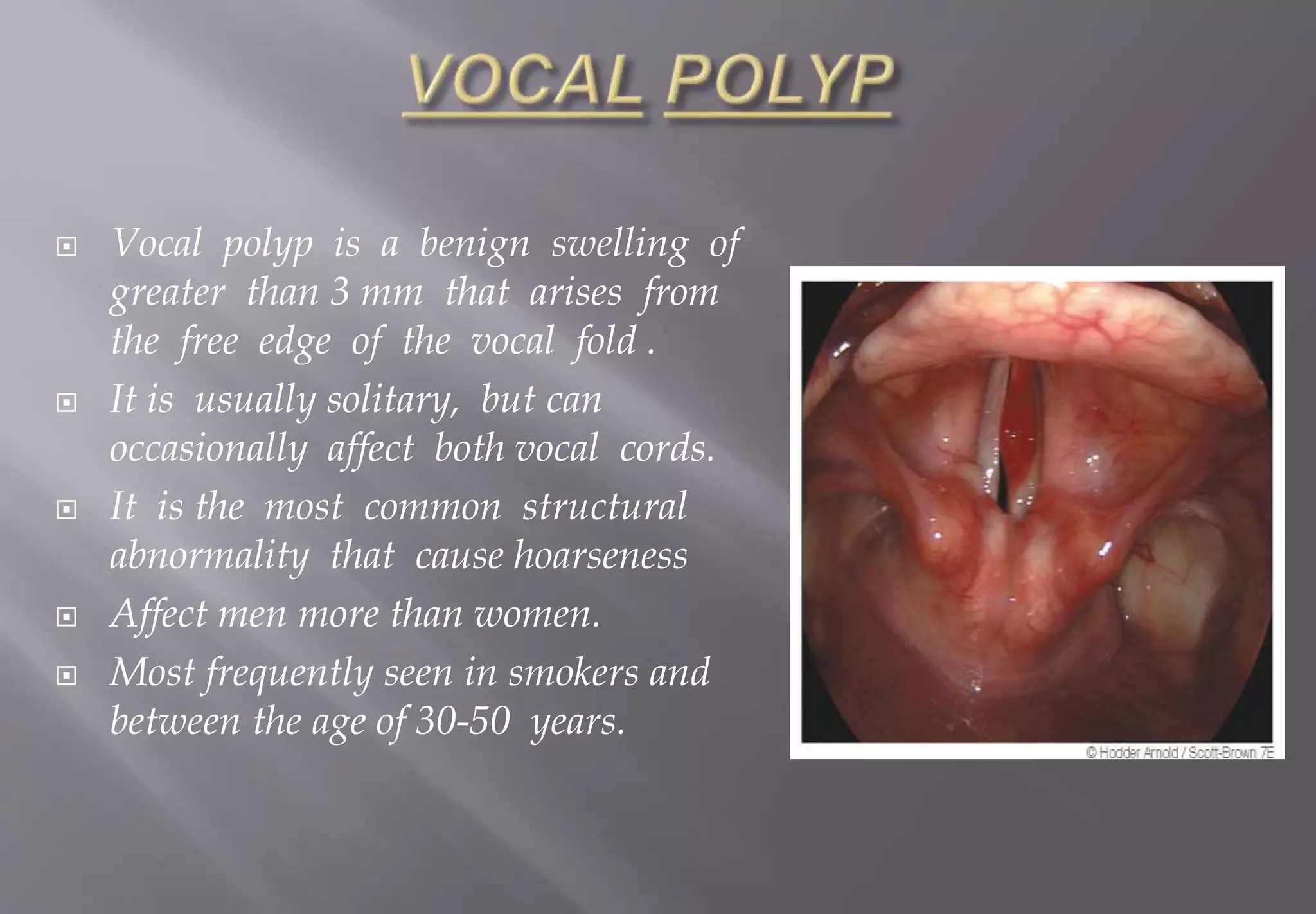 Benign disorders of larynx | PPTX