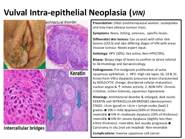 Benign Disorders of the Vulva: Pruritus (itchy) Vulva Vulval Skin and…
