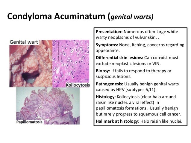 Benign Disorders of the Vulva: Pruritus (itchy) Vulva Vulval Skin and…