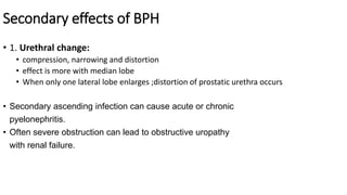 Benign enlargement of prostate | PPTX