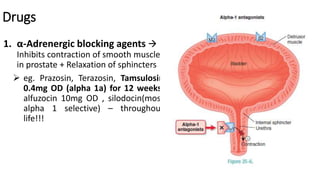 Benign enlargement of prostate | PPTX