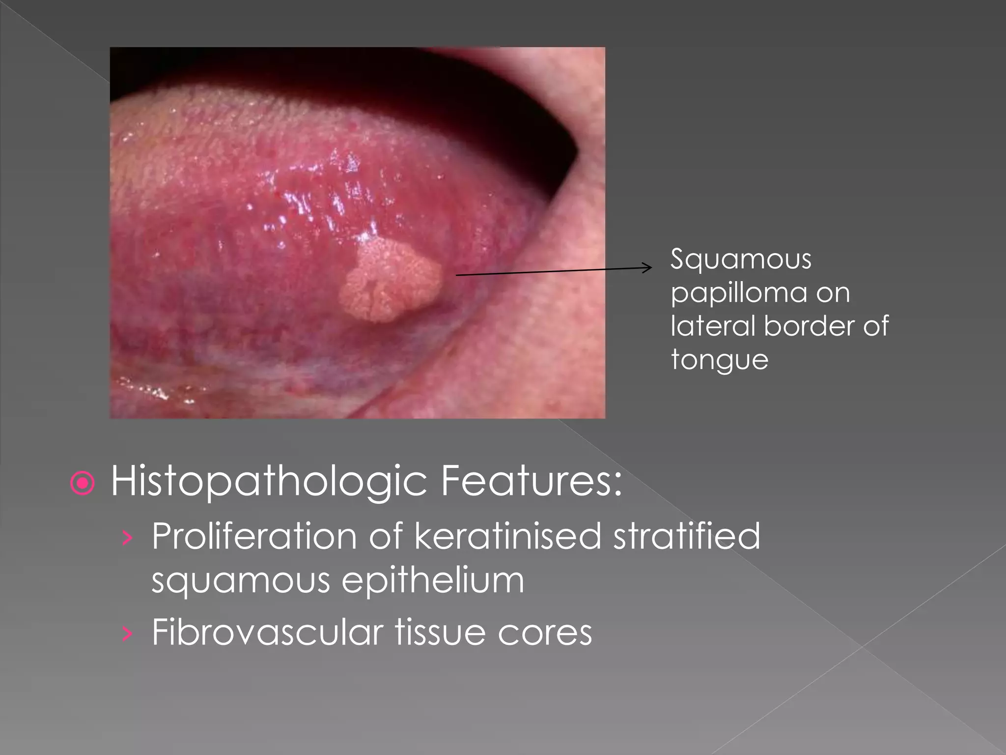 Benign Epithelial Pathology | PPTX