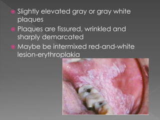 Benign Epithelial Pathology | PPTX