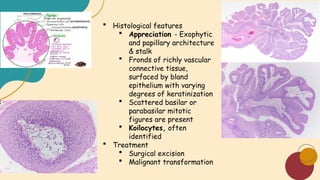 Benign Epithelial Tumors.PMNM Dental collegepptx | PPTX