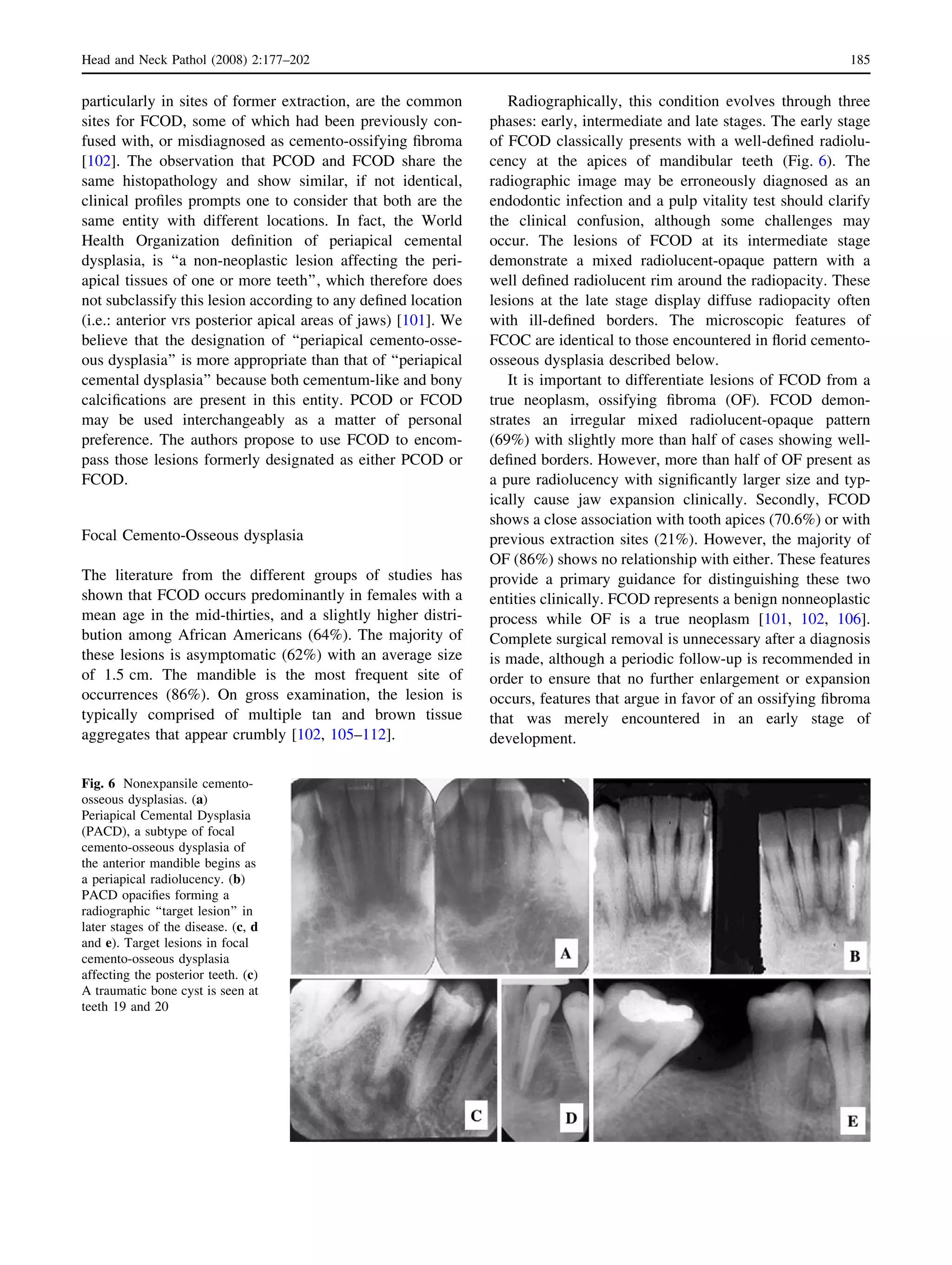 Benign fibroosseous lesions | PDF