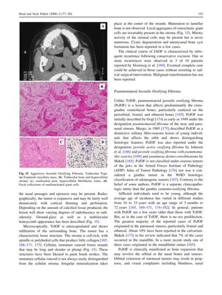 Benign fibroosseous lesions | PDF