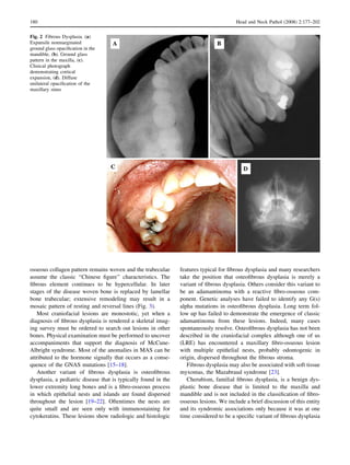 Benign fibroosseous lesions | PDF