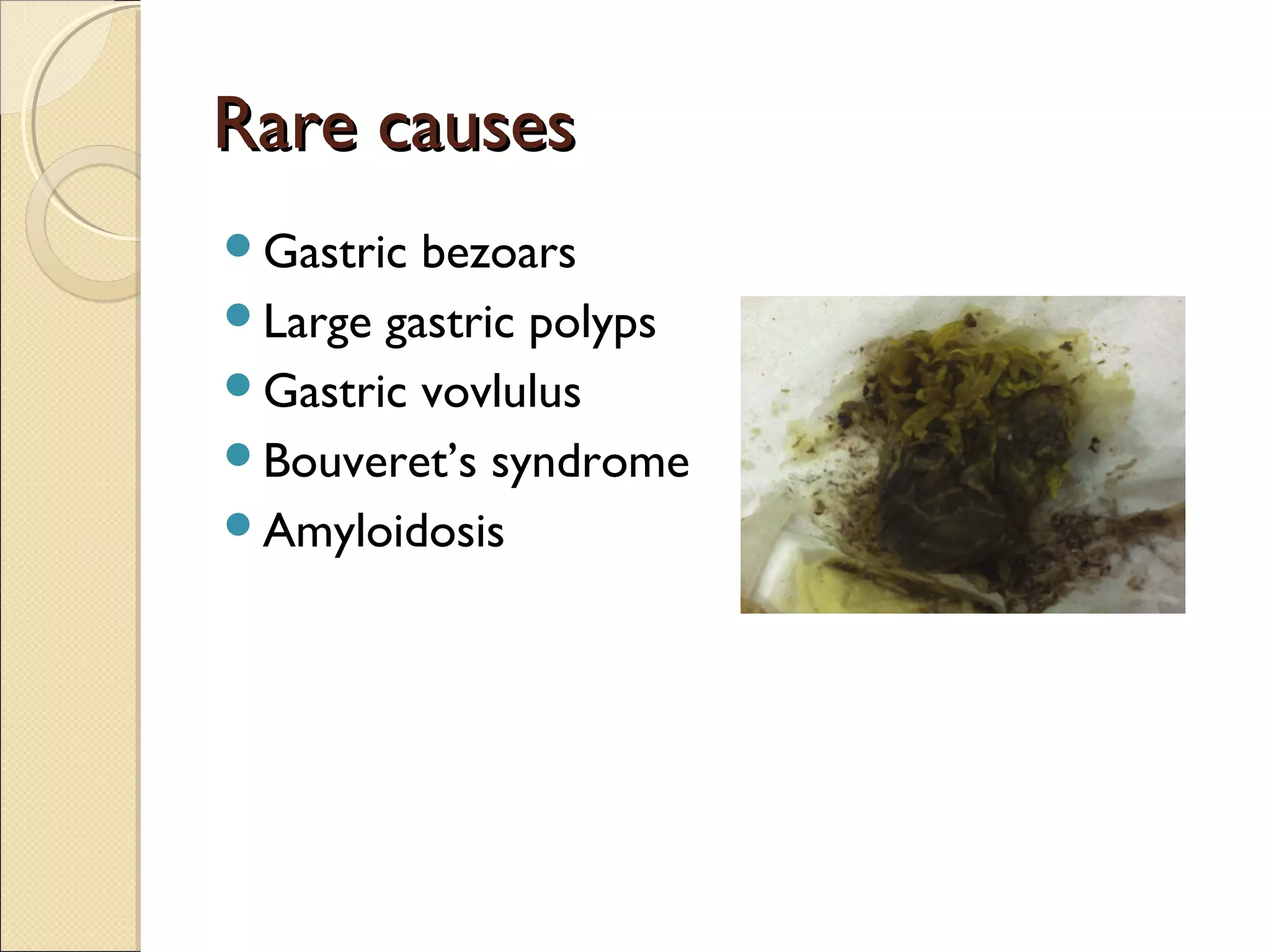 Benign gastric outlet obstruction | PPT