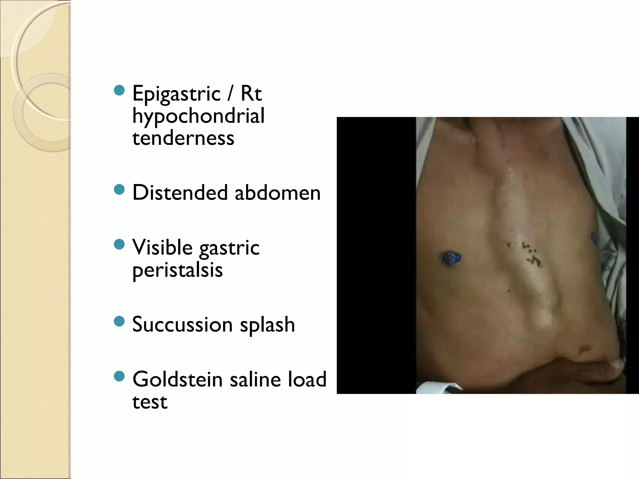 Benign gastric outlet obstruction | PPT