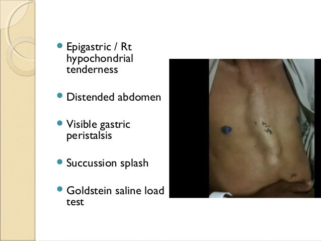 Benign gastric outlet obstruction