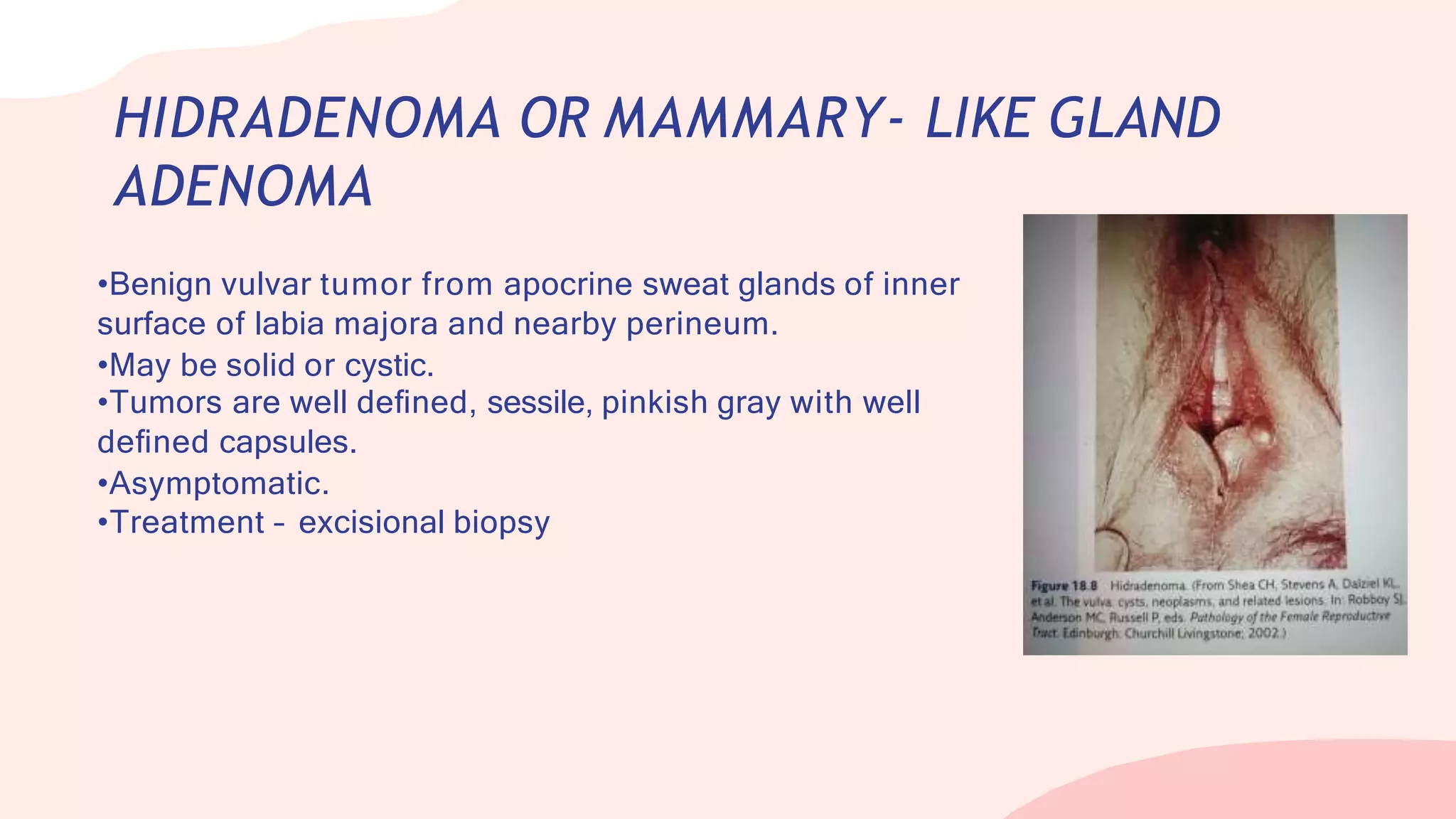 Benign Gynecologic Lesions.pptx