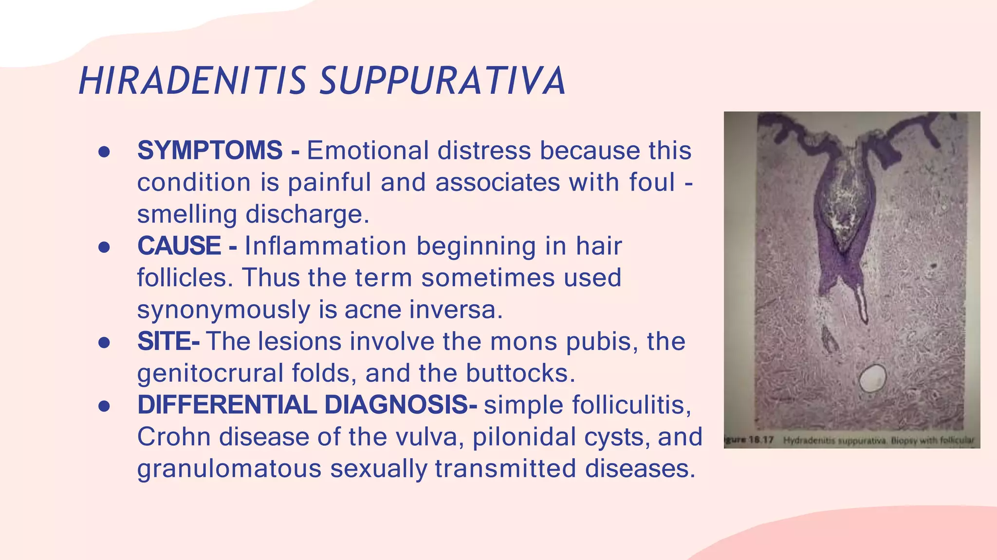 Benign Gynecologic Lesions.pptx