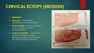 benign lesion of cervix.pptx benign lesion of cervix | PPT