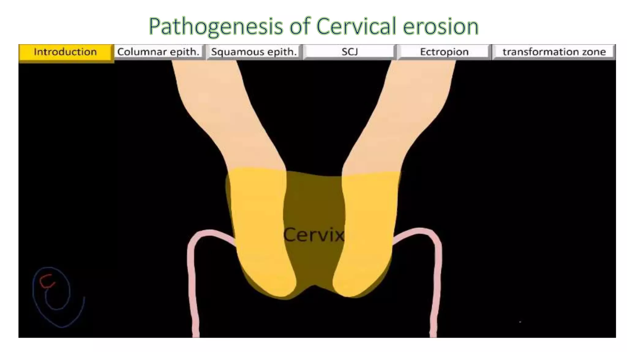 Homoeopathic point of view Benign lesion of the Cervix & Malignancy of ...