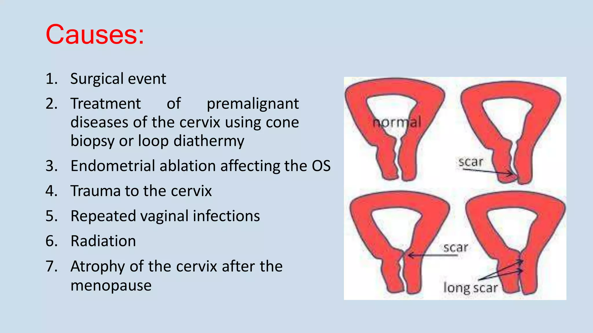 Benign lesions of cervix | PPTX