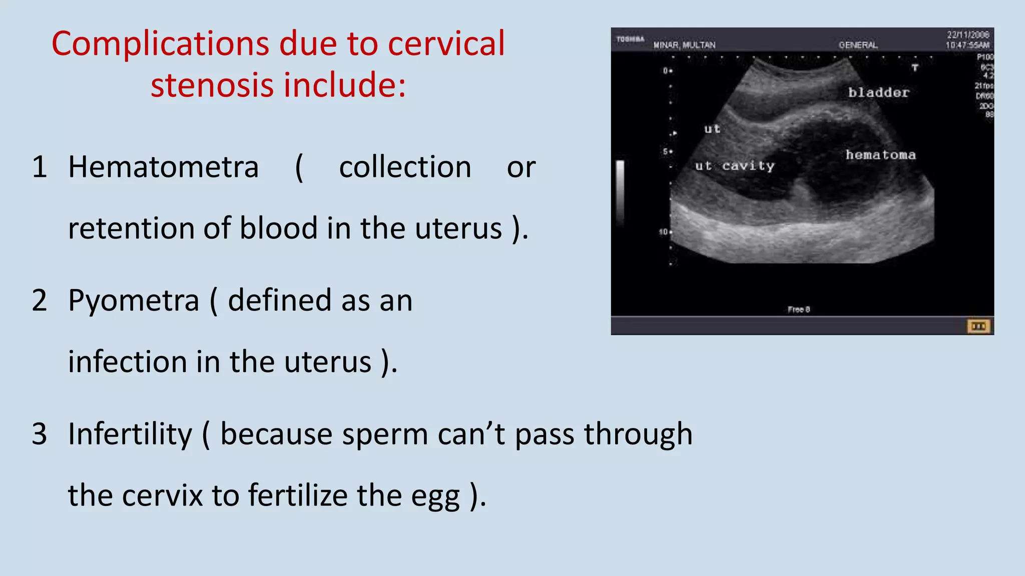 Benign lesions of cervix | PPTX