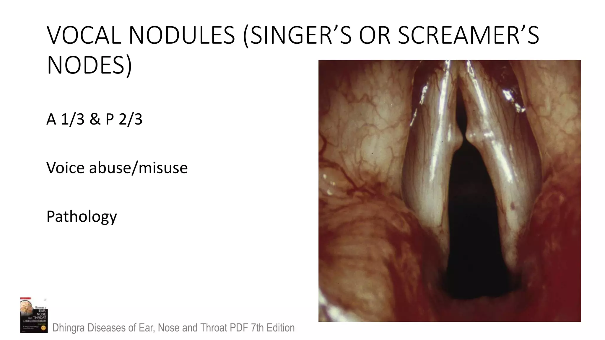 Benign lesions of larynx | PPTX