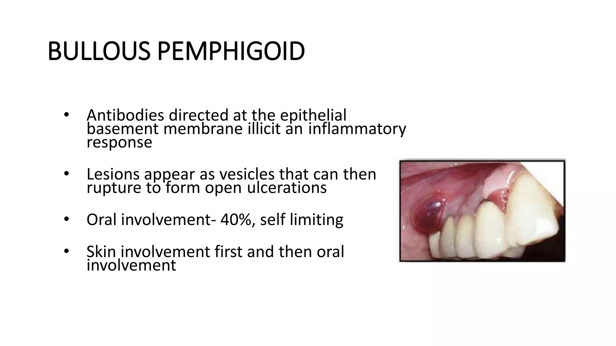 Benign Lesions of Oral Cavity.pptx
